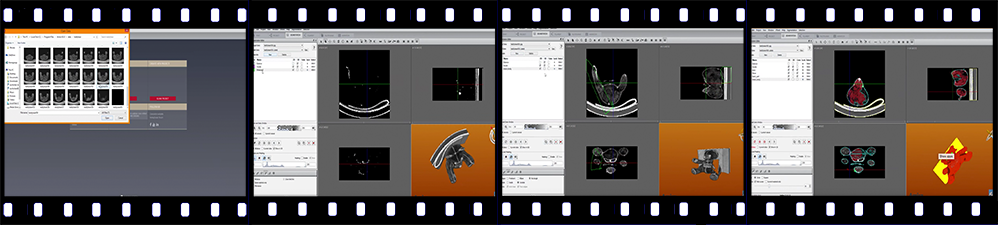 How to work with Amira :: Documentation for Hugo Learn Theme